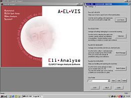 ELISPOT Software